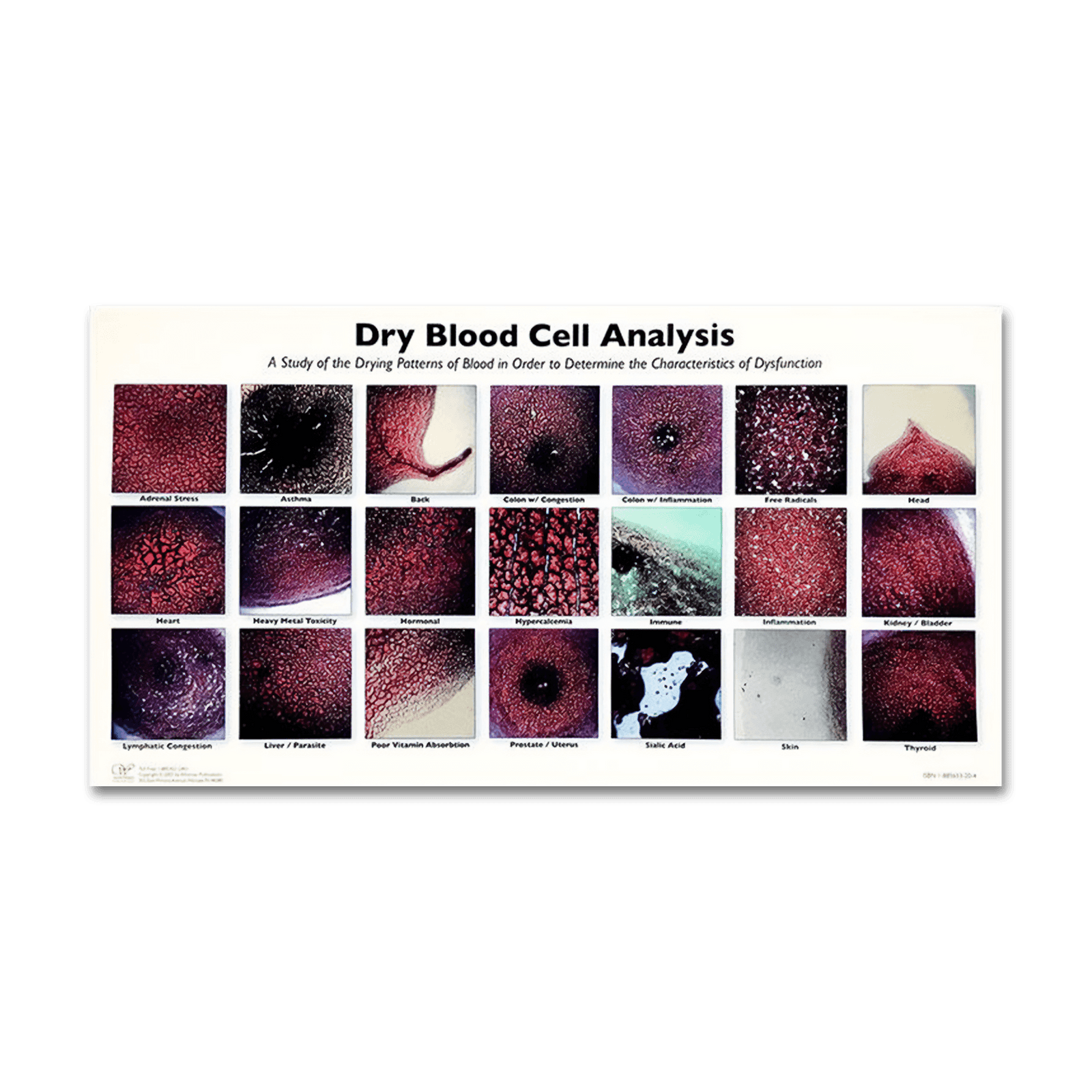 Dried Blood Cell Analysis Chart